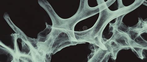 X Ray Revealing Intricate Structure Of Deer Antlers With Detailed Bone