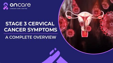 Stage 3 Cervical Cancer Symptoms Full Guide To Early And Advanced Signs