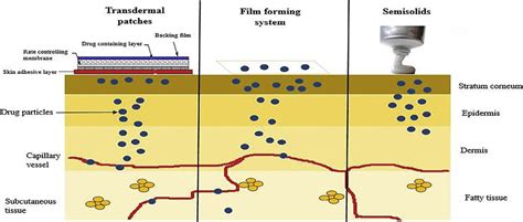 Transdermal Patch Diagram Full Article A Comprehensive Review On