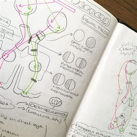 Once I Learned These Diagrams I Understood All Visual Field And