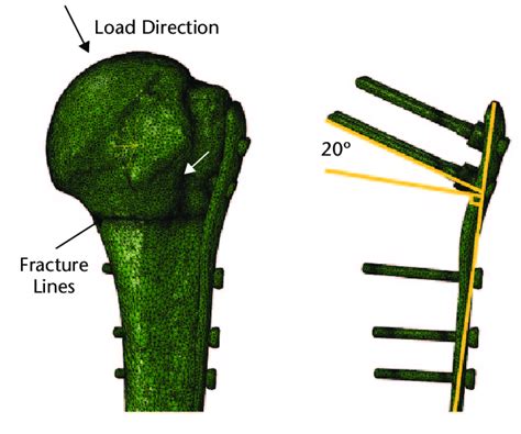 A B Examples Of The Finite Element Model For Evaluation Of The
