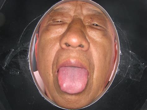 Face Tougue Object Detection Dataset And Pre Trained Model By Pku