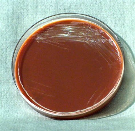 Free Picture Colonial Morphology Exhibited Colonies Brucella