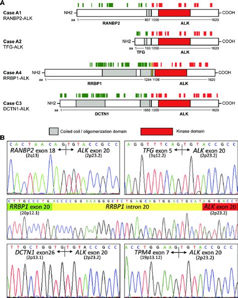 A Each Of Four Aberrant Alk Proteins Characterized By Mass