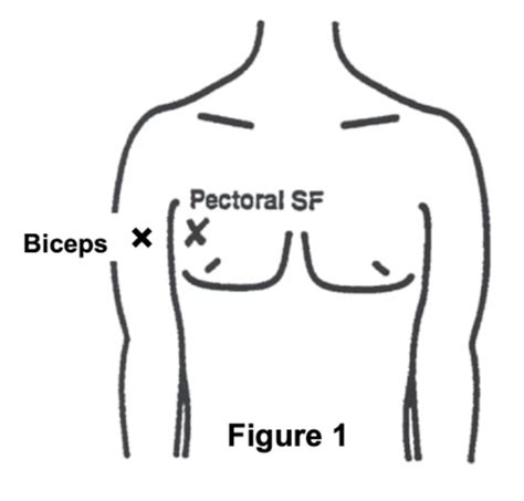 Practical Lab 3 Anthropometry Flashcards Quizlet