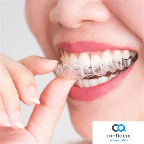 Why More Patients Are Choosing Invisalign Over Braces