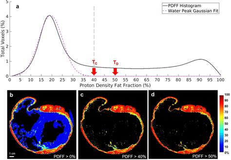 Histogram Of The Proton Density Fat Fraction Histogram Of The Proton