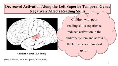 Structure And Function Of The Left Temporal Lobe Ppt