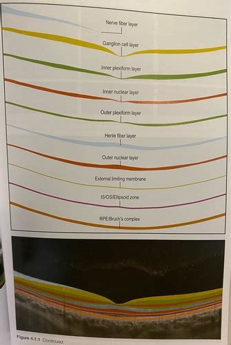 Oct Posterior Eye Flashcards Quizlet