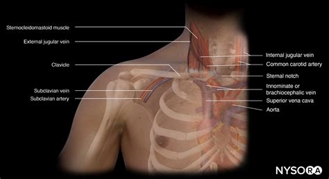 External Jugular Vein A Dsa Venous Phase After The Ligation Of