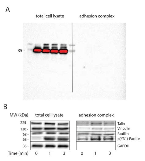 Video Analyzing Cell Surface Adhesion Remodeling In Response To