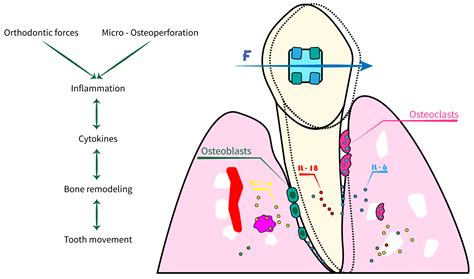 Drugs Affecting Tooth Movement At Kenneth Neilson Blog