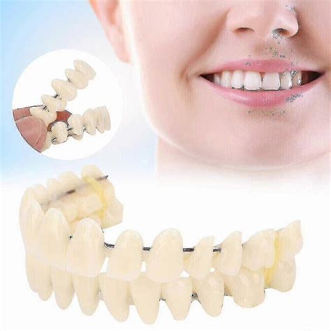 Upper Lower Dental Veneers Dentures Snap On False Teeth For A Perfect