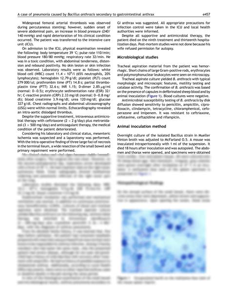 Solution A Case Of Pneumonia Caused By Bacillus Anthracis Secondary To Gastrointestinal Anthrax