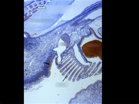 Schaubild „polyplacophora“ Quizlet