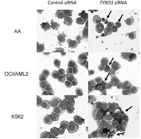 Tyro3 Knockdown Suppresses The Growth Of Myeloid Leukaemia Cells