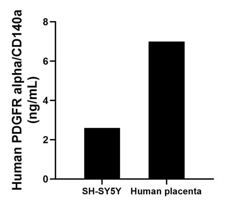 Pdgfr Alpha Cd140a Antibody 84383 7 Pbs Proteintech