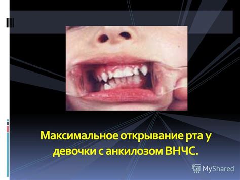 Презентация на тему: "Тернопольский государственный медицинский ...