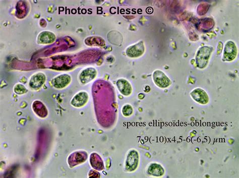 Microscopie Basidiospore De Hyphoderma Argillaceum B Clesse