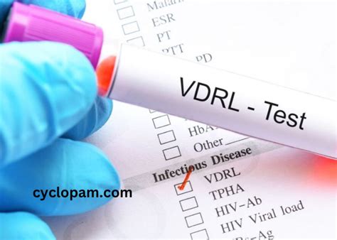 Vdrl Test In Hindi