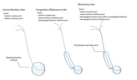 Sengstaken Blakemore Minnesotta And Linton Nachlas Tubes Deranged