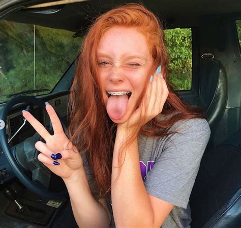 Beautiful Ginger With Braces