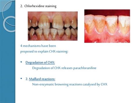 Chlorhexidine