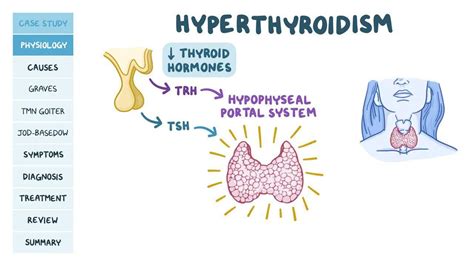 Hyperthyroidism Pathology Review Video And Anatomy Osmosis