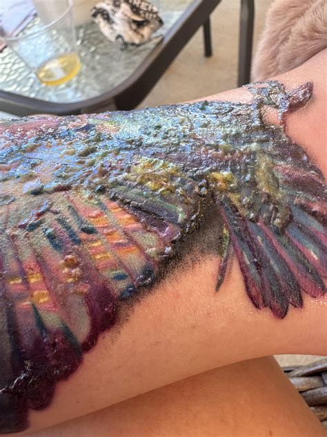 Healed Infected Tattoo
