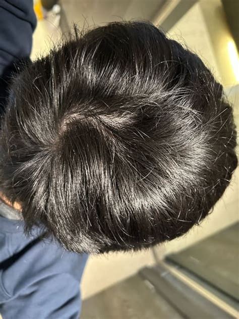 各位可以幫我看一下這樣是不是禿頭前兆嗎 男性保養板 Dcard