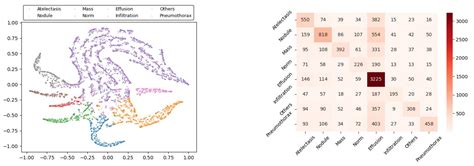 Medical Image Classification Based On Semi Supervised Generative