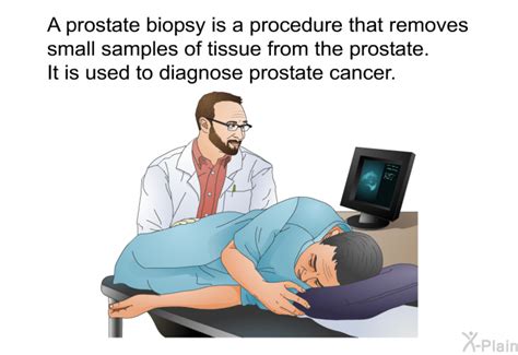 Prostate Biopsy