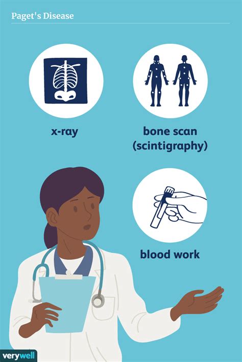 Pagets Disease Of Bone And Its Symptoms And Treatment