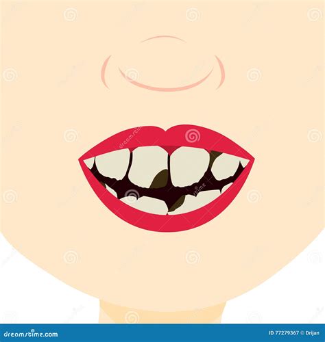 Person With Decayed Teeth At Dentistry Vector Cartoon Stick Figure