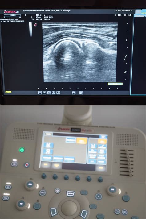 Sonographie Rheumapraxis Augsburg