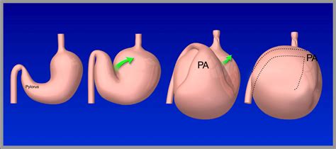 Prophylactic Gastropexy — Vsx Veterinary Surgery