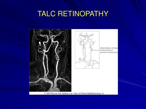 Ppt Addiction And Vision Loss Powerpoint Presentation Free Download