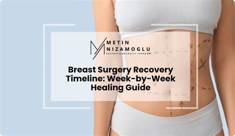 Breast Surgery Recovery Timeline Week By Week Healing Guide Mr