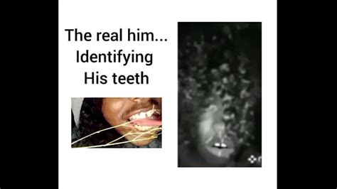 Identifying His Teeth Triviaandthe Real Him Pt2and Xxx Mobile Porno