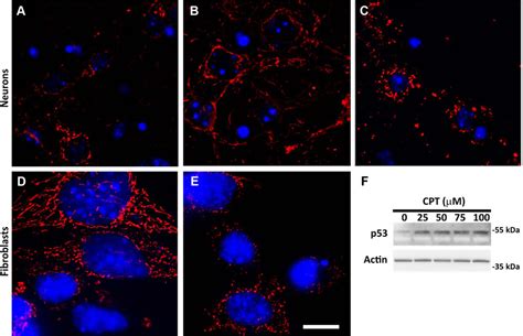 Cpt Treatment Increases Mitochondrial Length In Neurons But Induces Download Scientific Diagram