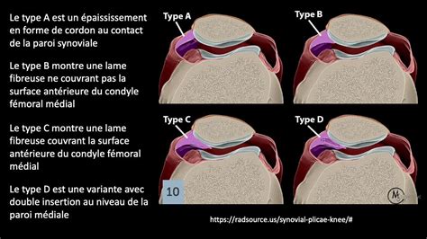 Philippe Meyer On Linkedin Classifications Utiles Usefull Classifications Classification De