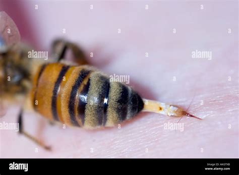 Bee Stinger Close Up