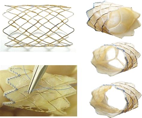 Depiction Of The Melody Tpv At Various Stages Of Production And In Download Scientific Diagram