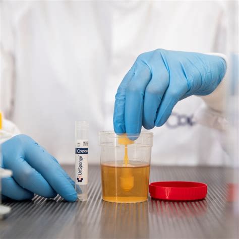 Urisponge® System For Urine Specimens Copan