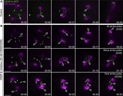 Any Chromosome May Use Either The Cenp E Dependent Or Download