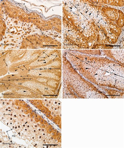 The Process Of Apoptosis In A Holocrine Gland As Shown By The Avian