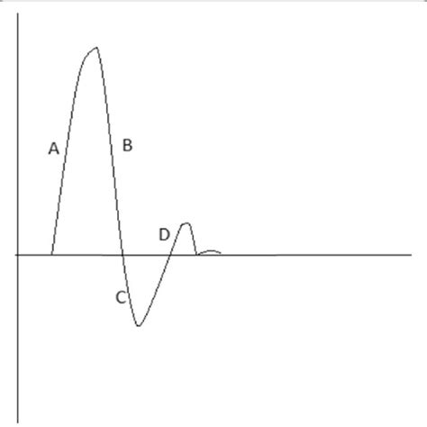 Examples Of Monophasic Waveforms Including Decreased Amplitude A