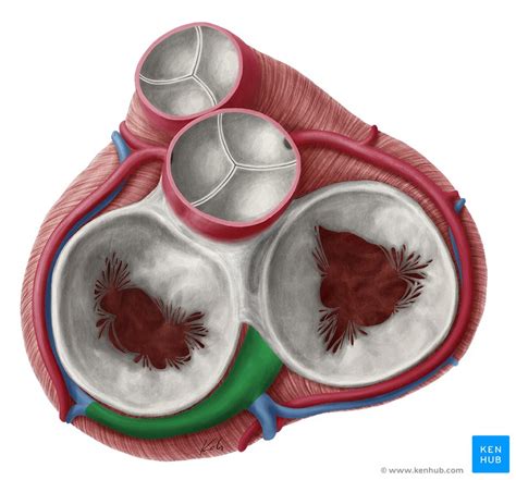 Coronary Sinus Filecoronary Sinuspng Wikimedia Commons