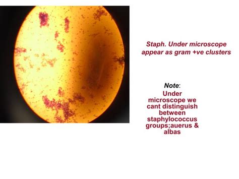 Staphylococcus And Streptococcus Ppt Blood Disorders Diseases And