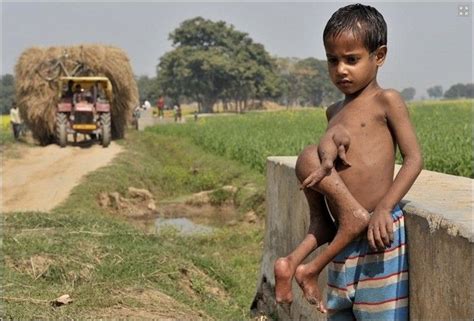 Parasitic Twin 12 Pics